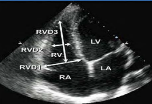 Echo Reference Values | Marc Katz MD