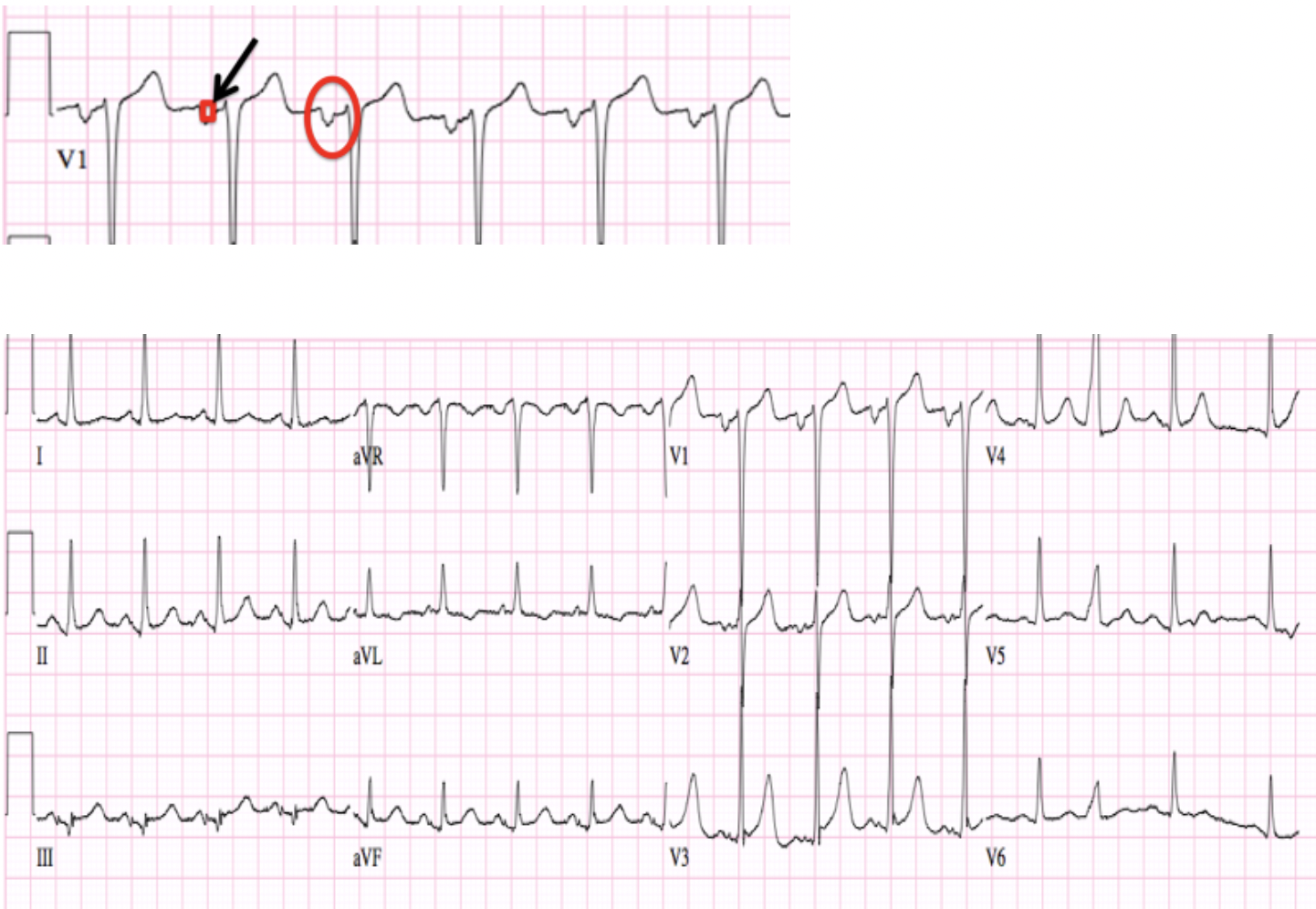 ECG Reference Guide For Medical Trainees | Marc Katz MD