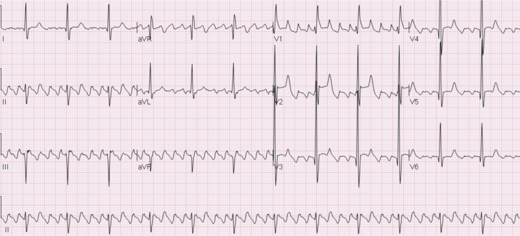 ECG Reference Guide For Medical Trainees | Marc Katz MD