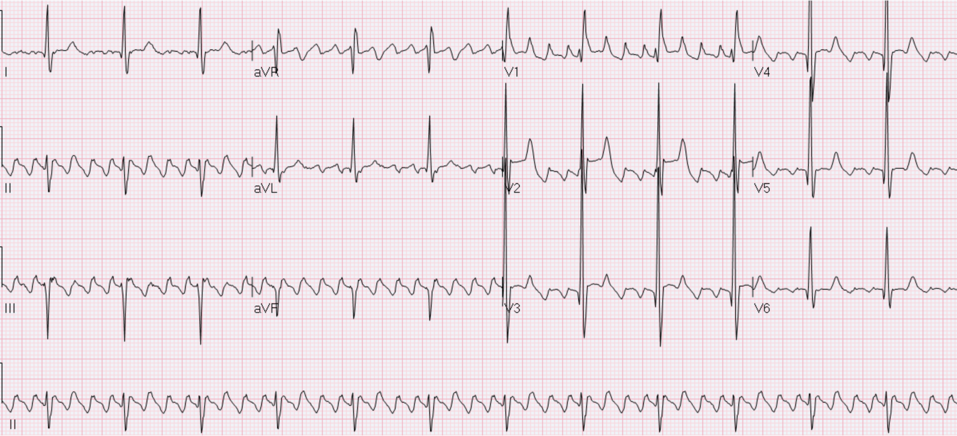 ECG Reference Guide For Medical Trainees | Marc Katz MD