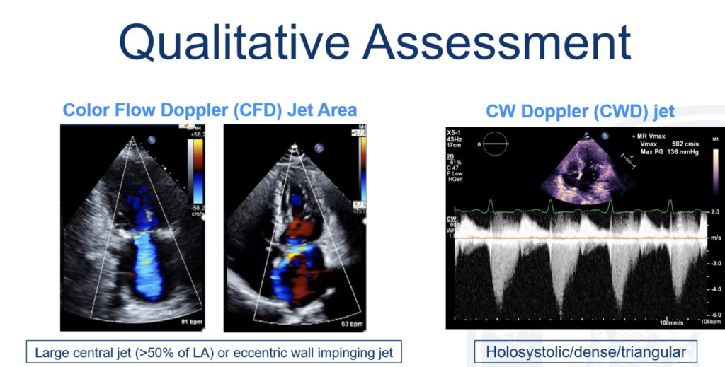 High Yield Board Review Notes for Cardiovascular Disease Fellowship ...