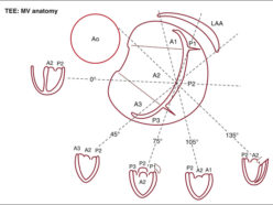 Echo Reference Values | Marc Katz MD